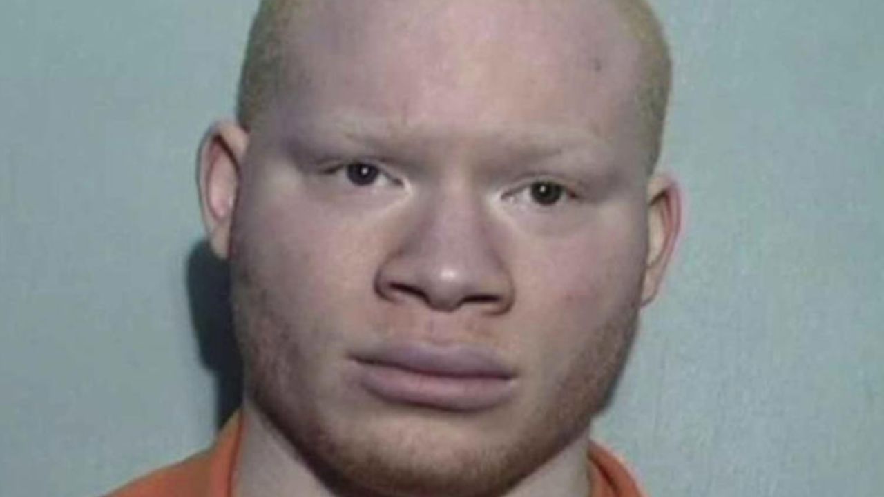BLM Activist "World’s Sexiest Albino" Faces Charges Over $500K Fund ...